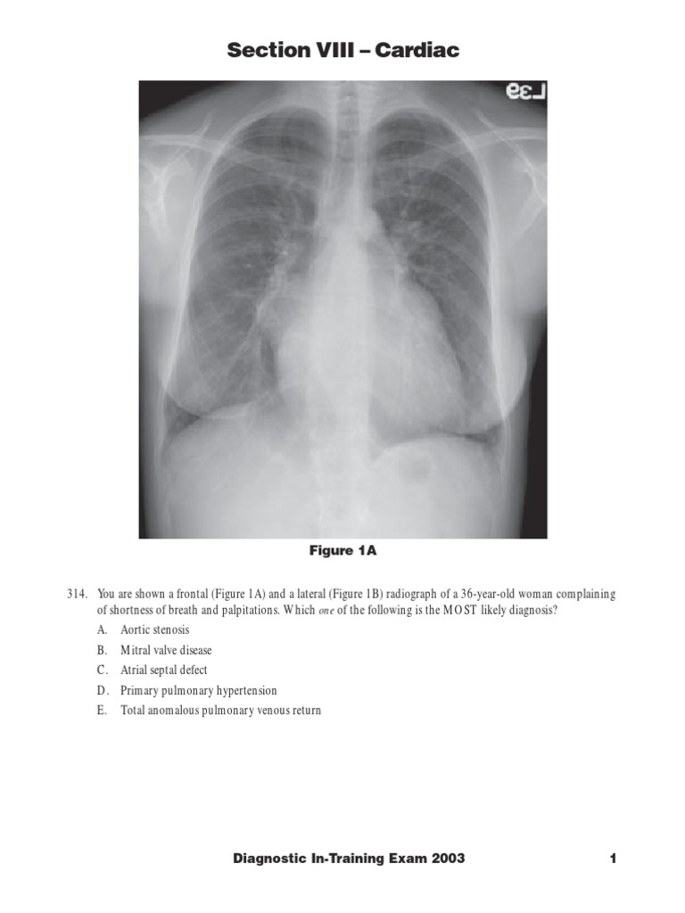 Cardiac Radiology. | Heart | Atrium (Heart)