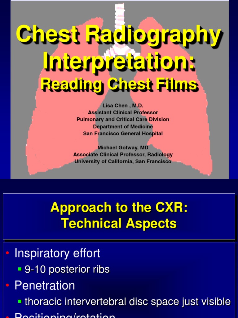 Chest Radiography Reading | PDF | Lung | Thorax