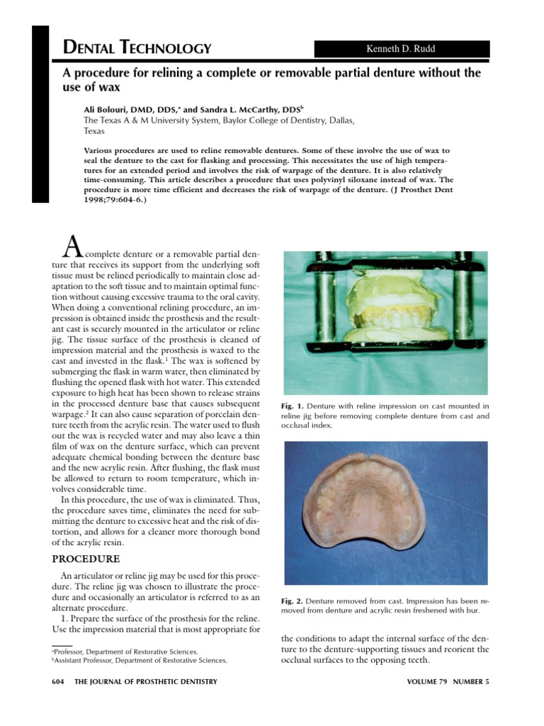 A Procedure For Relining A Complete or Removable Partial Denture ...