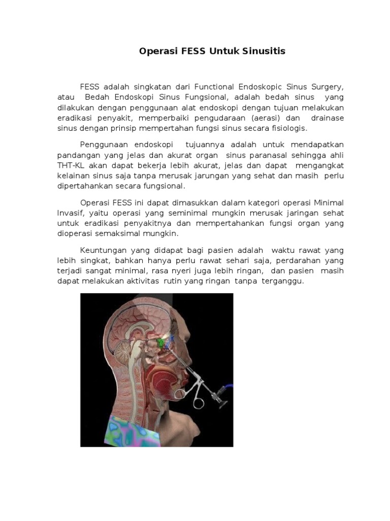 Panduan Operasi FESS untuk Sinusitis | PDF