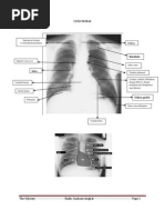 Kurva Pertumbuhan Intrauterine Lubchenco | PDF