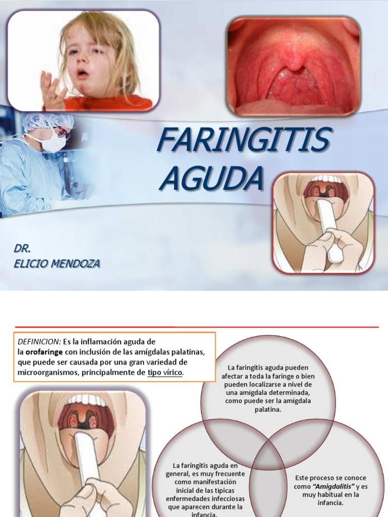 Faringitis Aguda | PDF | Influenza | Resfriado comun