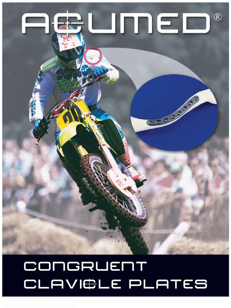 Acumed Clavicle | PDF | Implant (Medicine) | Anatomical Terms Of Location