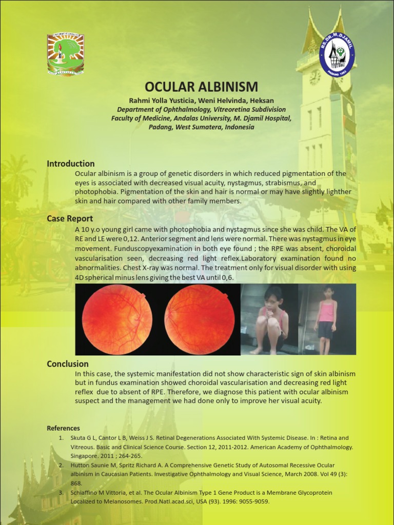 Ocular Albinism in Pediatric Patients | PDF | Human Eye | Vision