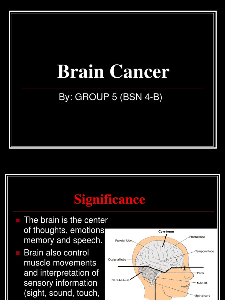 Brain Cancer Report | PDF | Brain Tumor | Glioma