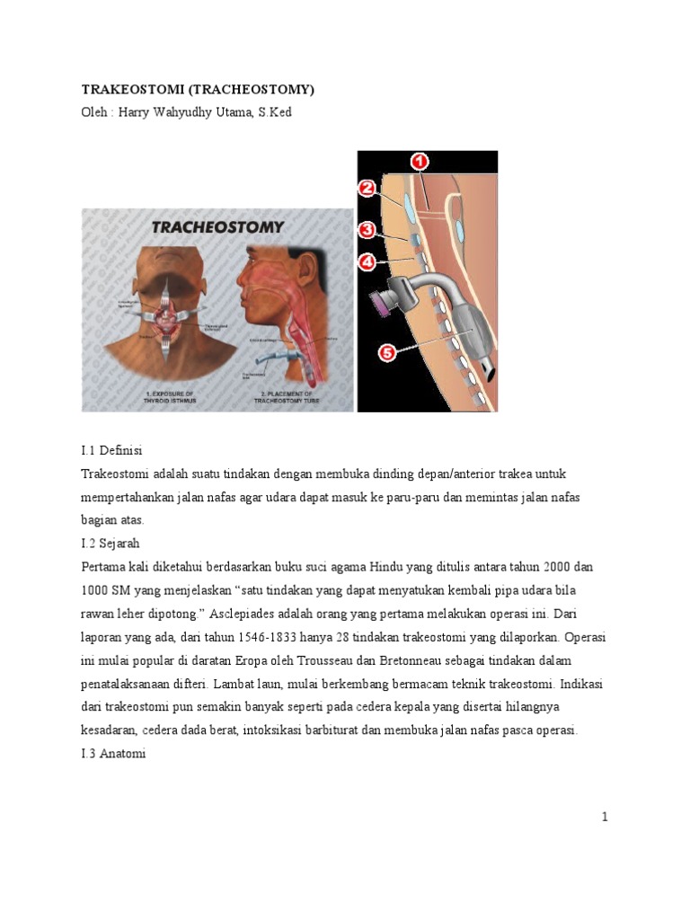 Trakeostomi-Ilmu Bedah-Indri | PDF | Kajian Bahasa Asing | Kesehatan ...