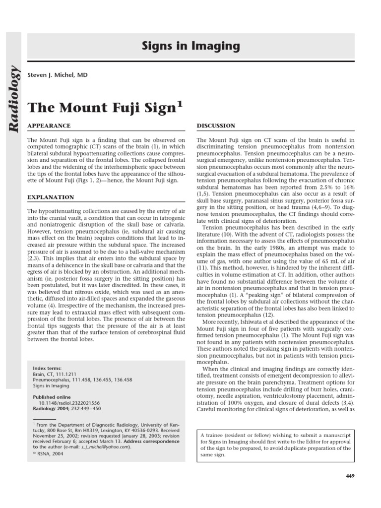 Pneumocephalus Mount Fuji Sign | PDF | Ct Scan | Radiology