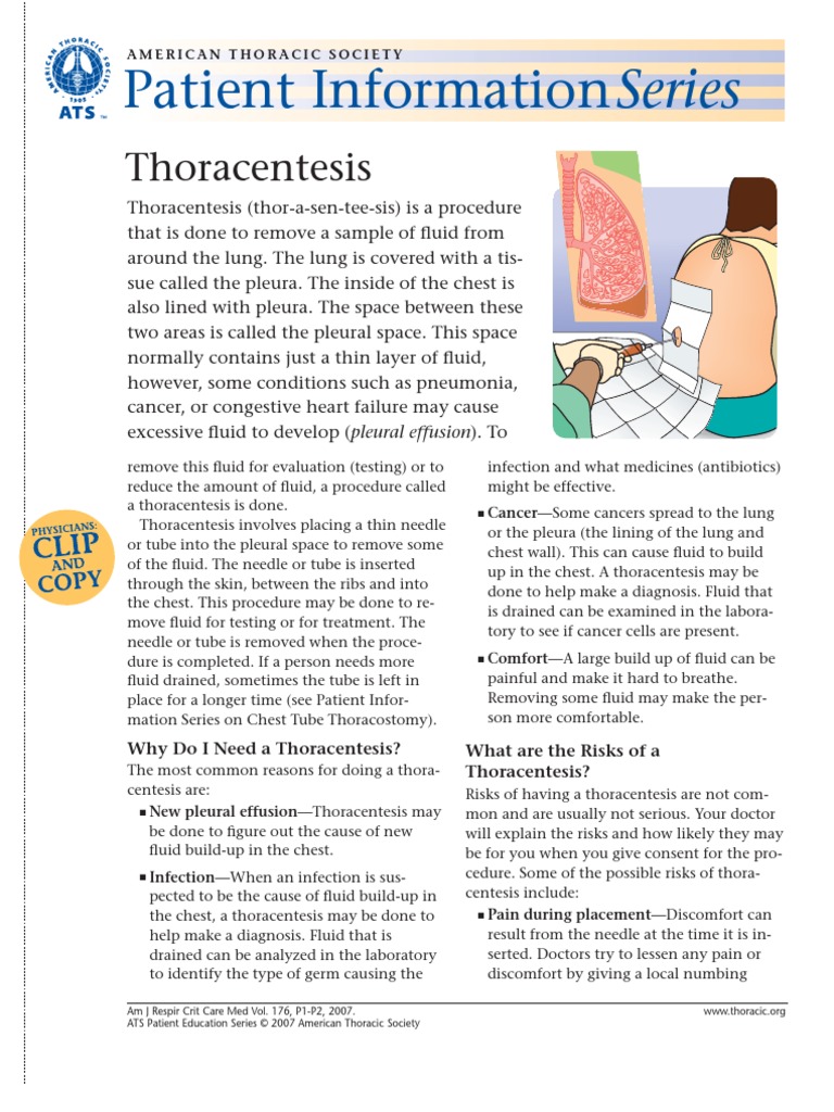 Thoracentesis | Thorax | Medicine