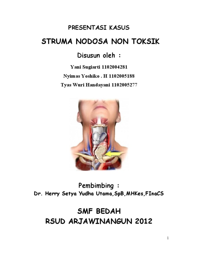 Struma Nodusa Non Toksik | PDF