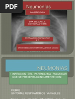 Fases Fisiopatologicas de La Neumonia | PDF | Leucocito | Sangre