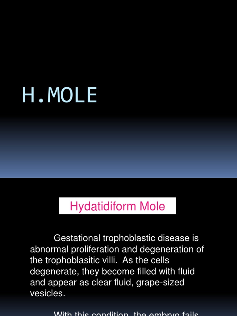 H-Mole (Case Study) | PDF | Pregnancy | Miscarriage