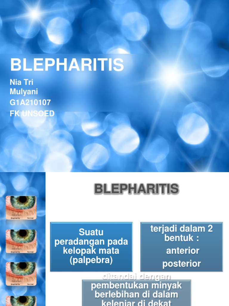 NIA Blepharitis Edit | PDF