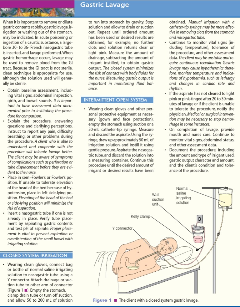 Gastric Lavage | PDF | Medical Specialties | Clinical Medicine