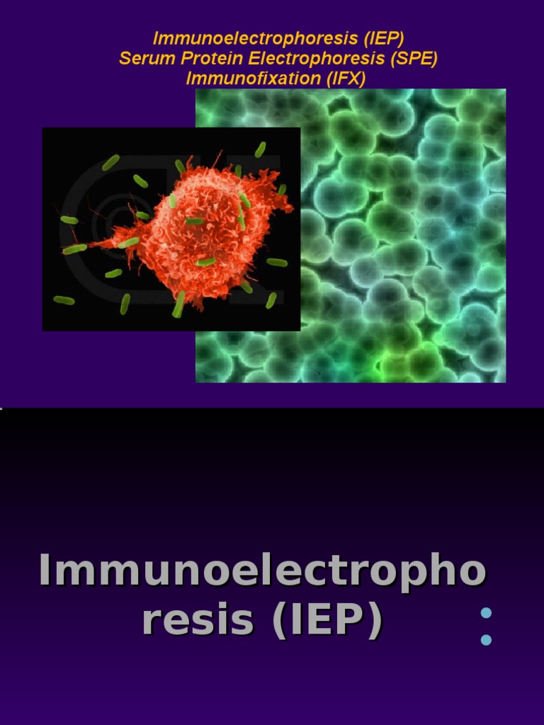 Immunoelectrophoresis (IEP), Serum Protein Electrophoresis (SPE ...