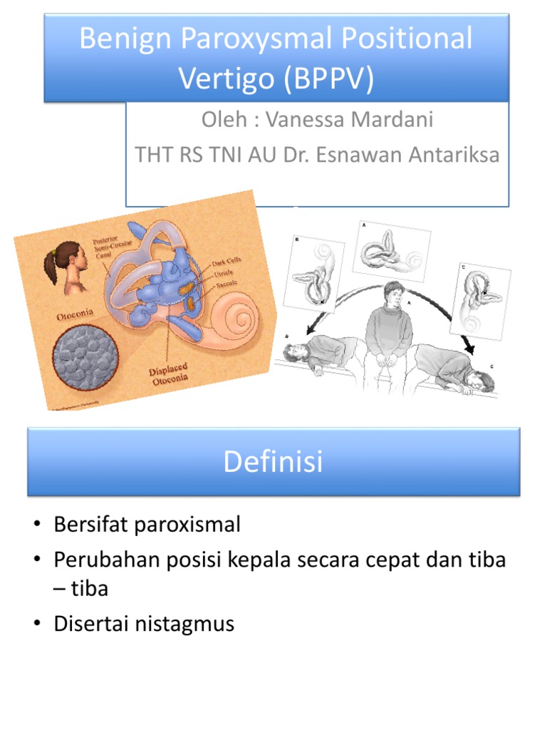 Referat BPPV | PDF