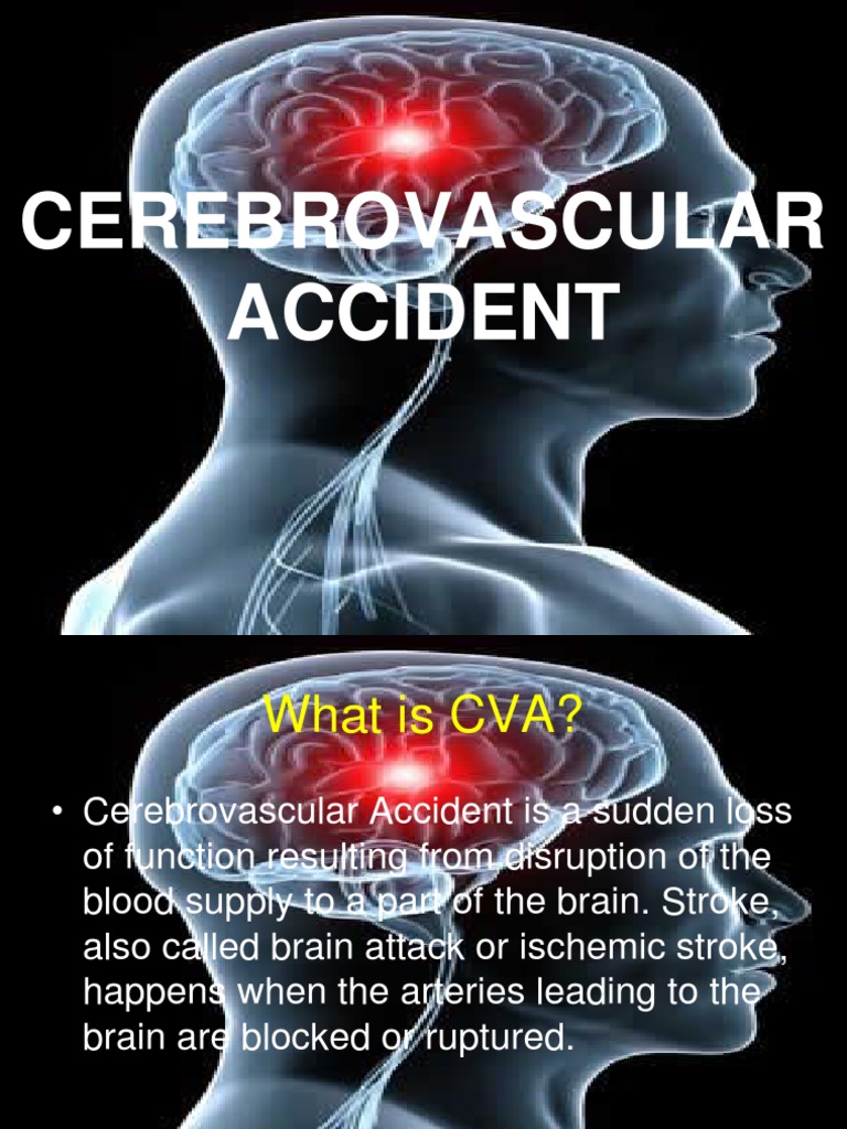 Cerebrovascular Intro | PDF | Stroke | Diseases And Disorders
