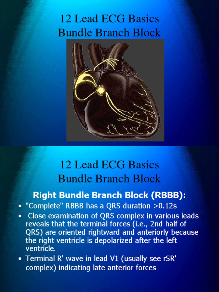 ECG Bundle Branch Block Guide | PDF | Teaching Methods & Materials ...
