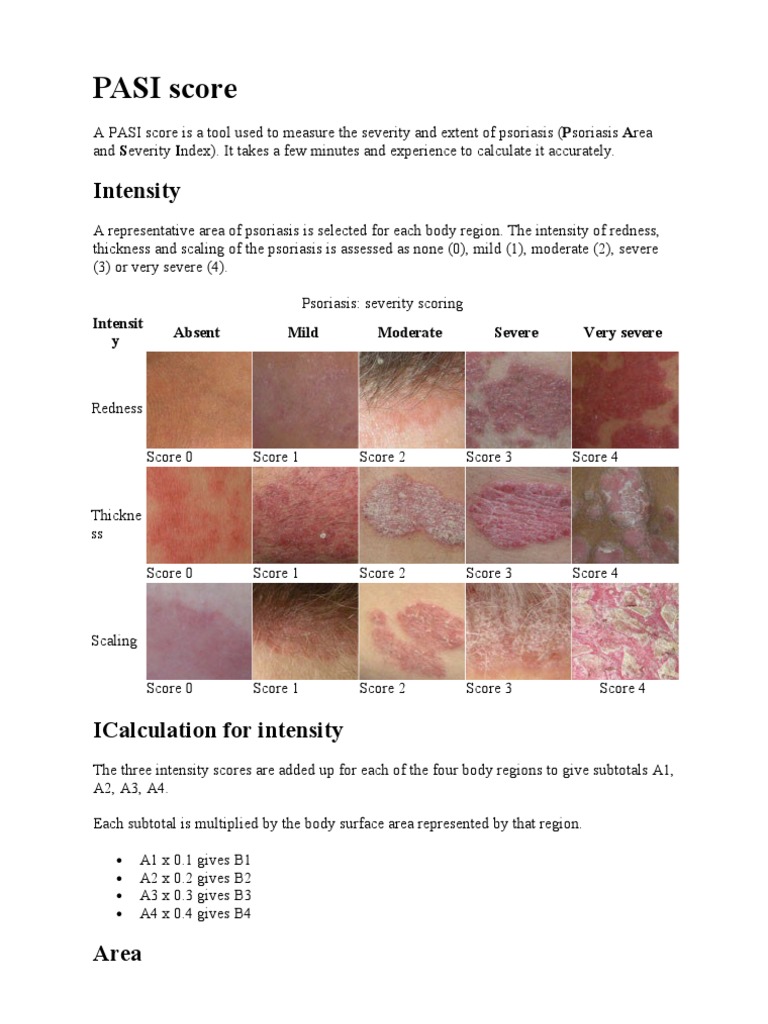 PASI Score 2003 | PDF