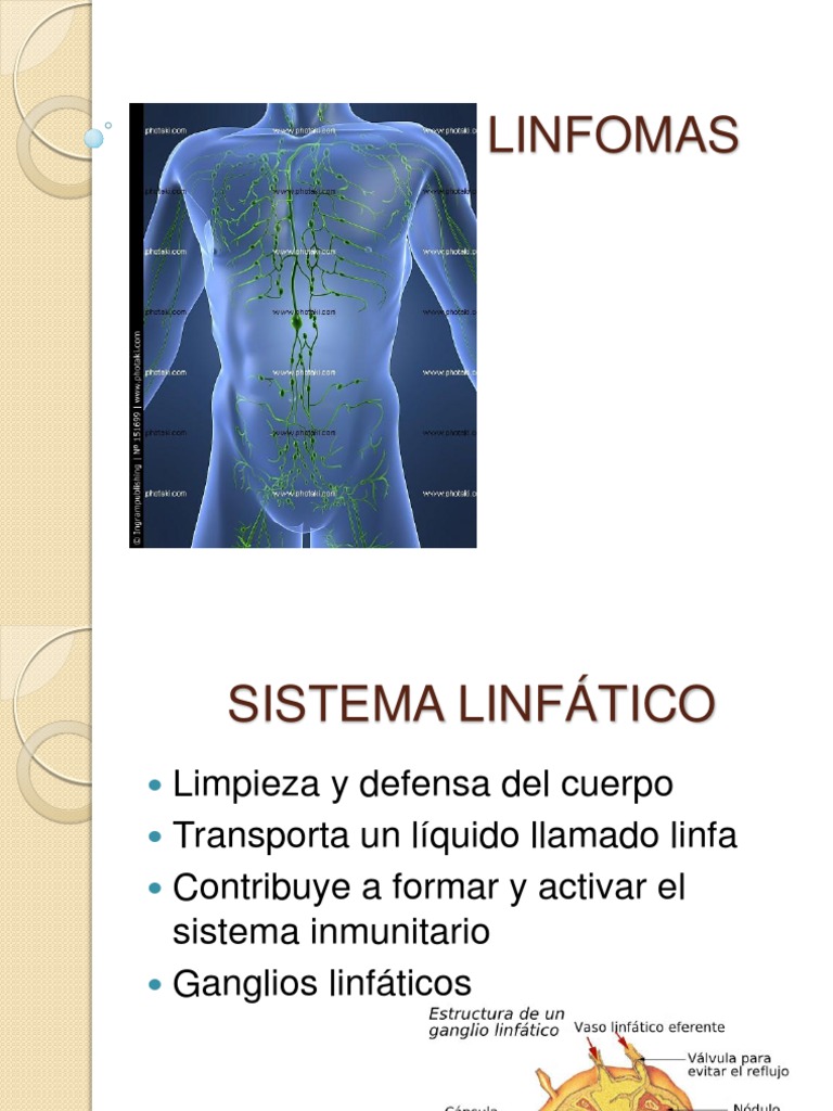 Clasificación y tratamiento de linfomas | PDF | Linfoma | Cáncer