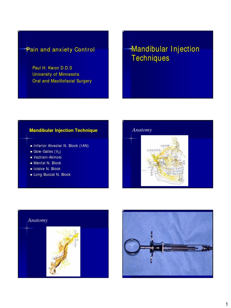 Mandibular Injection Techniques | PDF | Mouth | Face