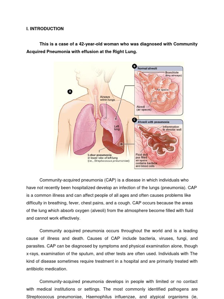 pneumonia with pleural effusion.docx | Respiratory Tract | Pneumonia