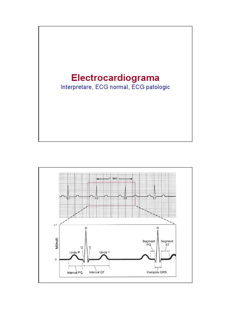 EKG Interpretare | PDF