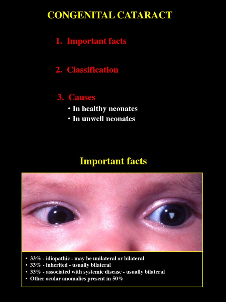 Understanding Congenital Cataracts | PDF