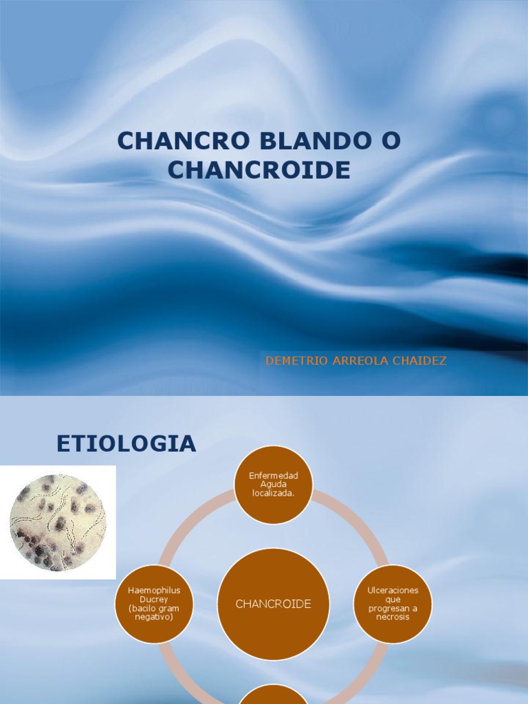 Chancro blando o chancroide: etiología, epidemiología, cuadro clínico ...