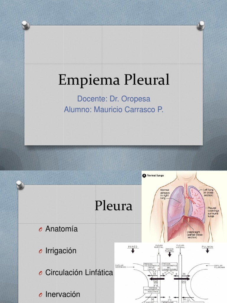 Empiema Pleural | PDF