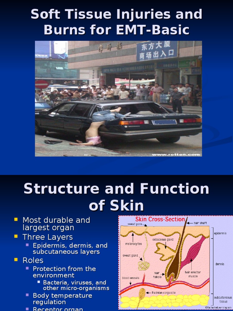EMT-Basic Guide to Soft Tissue Injuries | PDF | Burn | Wound