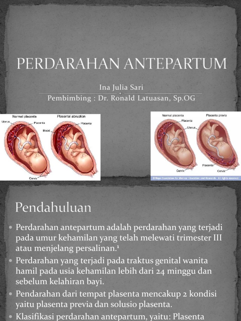 Perdarahan Antepartum | PDF