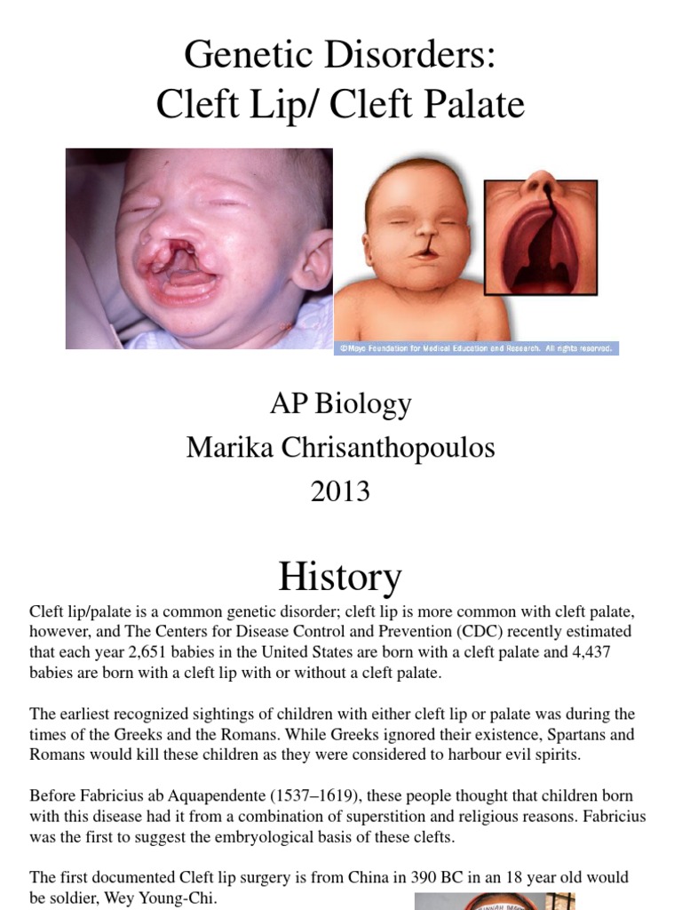 Chrisanthopoulos Marika 300453 Cleft Lip and Palate | PDF | Diseases And Disorders | Health Sciences