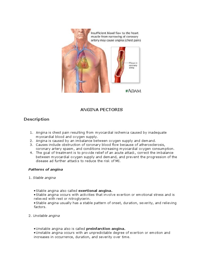 Angina Pectoris | Angina Pectoris | Coronary Artery Disease