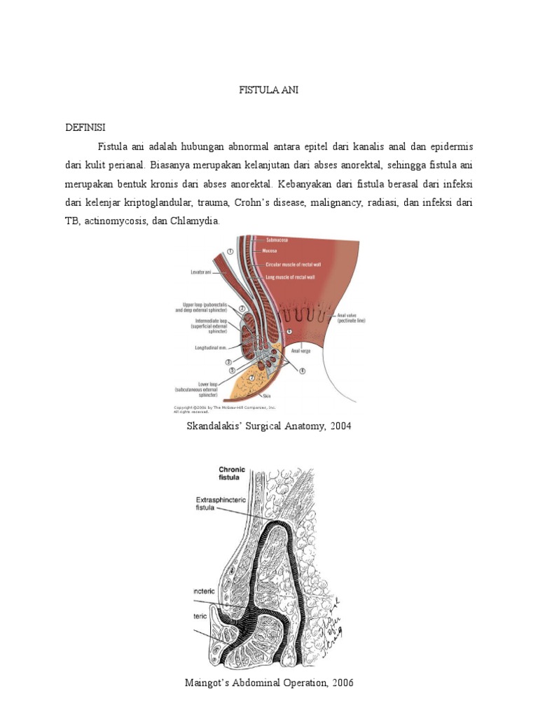 Fistula Ani | PDF