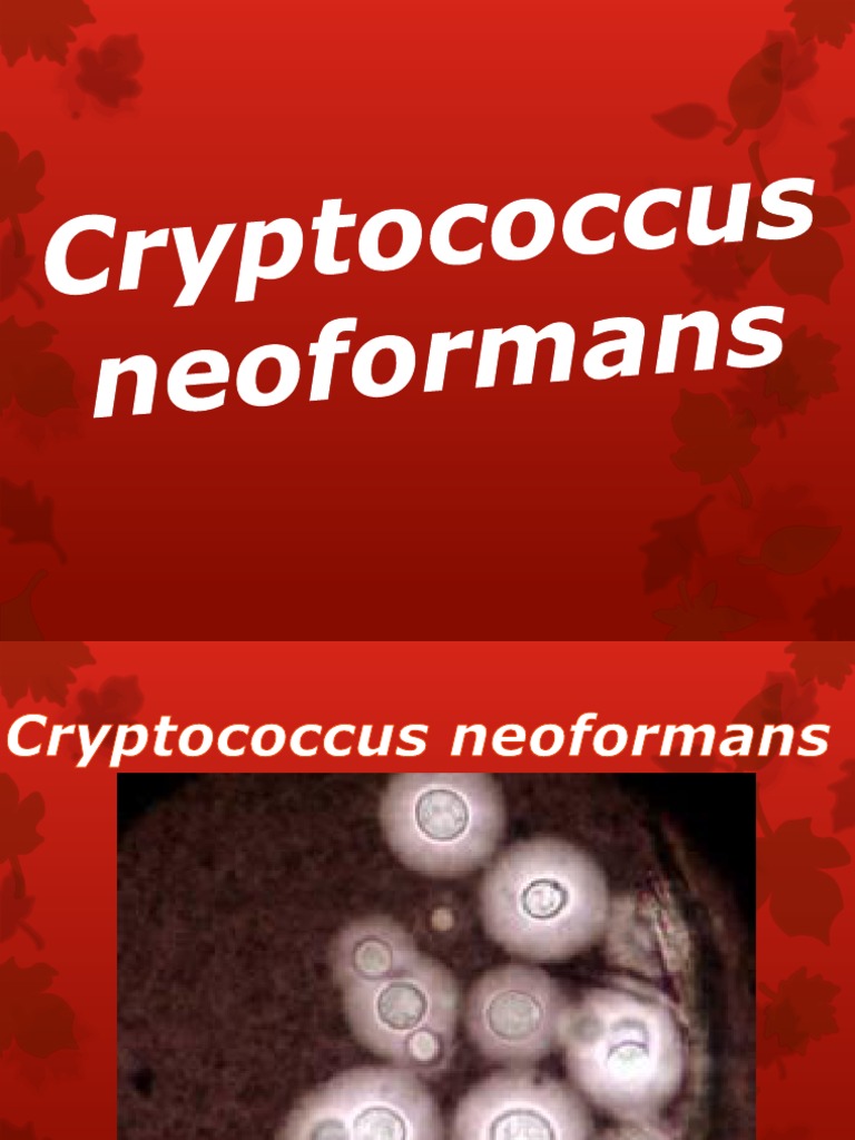 Criptococosis: Diagnóstico y Tratamiento | PDF | Hongo | Sistema ...