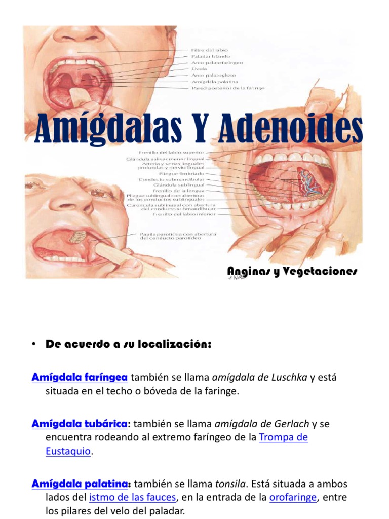 Amigdalas y Adenoides