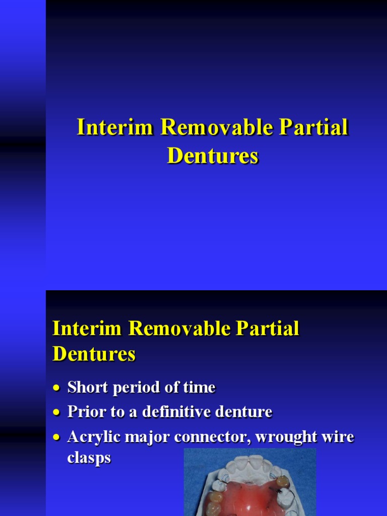 13. Interim RPD | Dentures | Dentistry