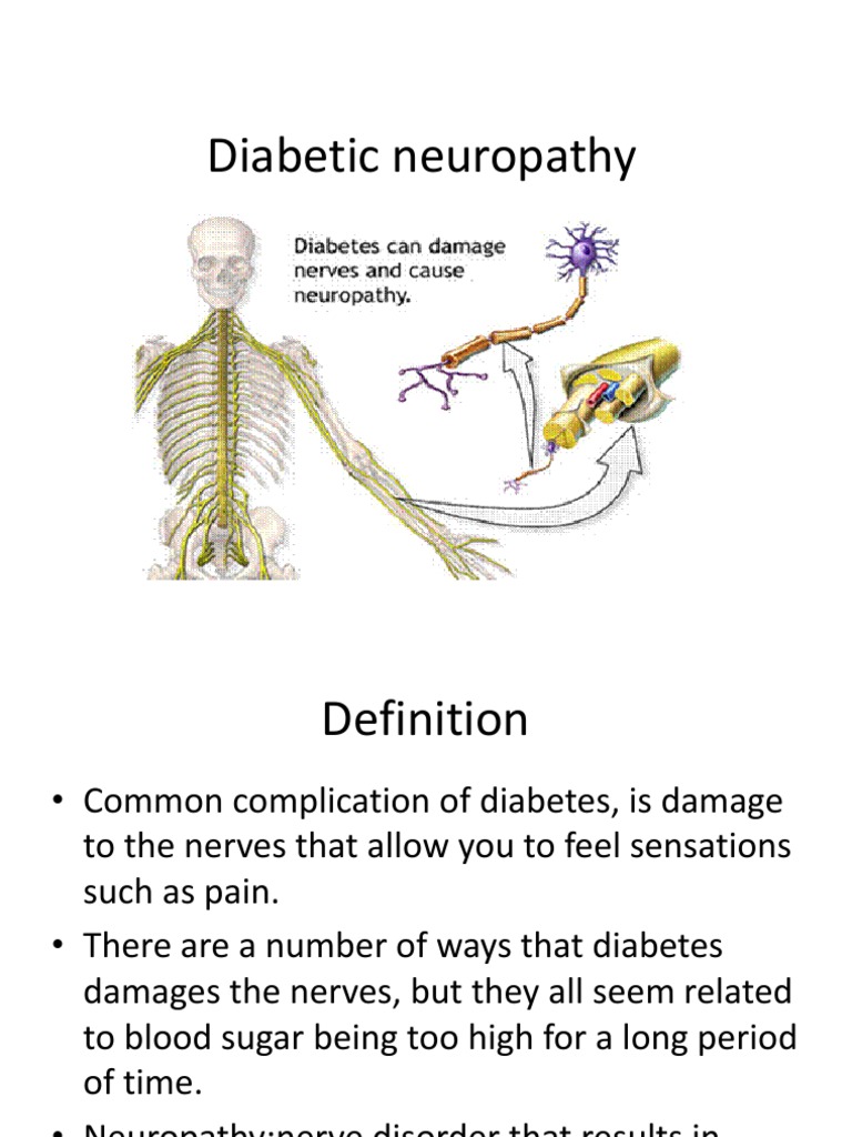 Understanding Diabetic Neuropathy | PDF | Peripheral Neuropathy | Nerve