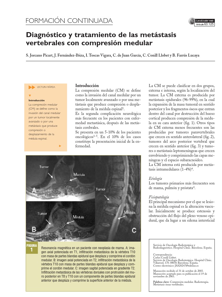 Compresion Medular Info | Descargar gratis PDF | Metástasis | Cáncer de pulmón