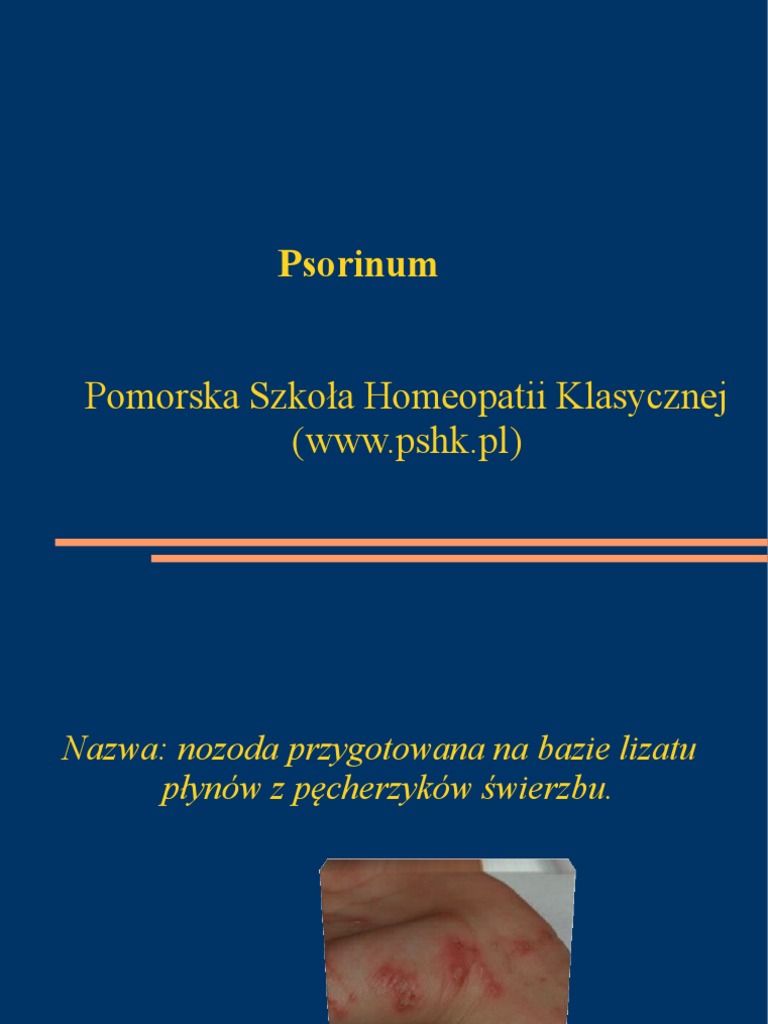 Psorinum | PDF