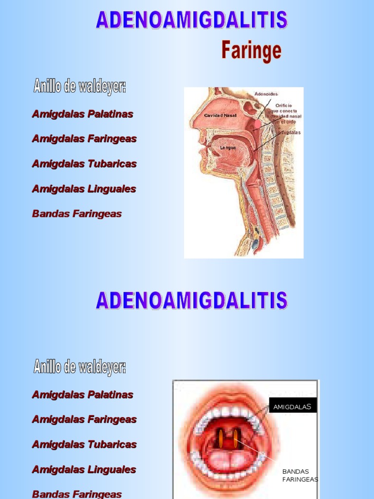 adenoamigdalitis | Estreptococo | Epidemiología