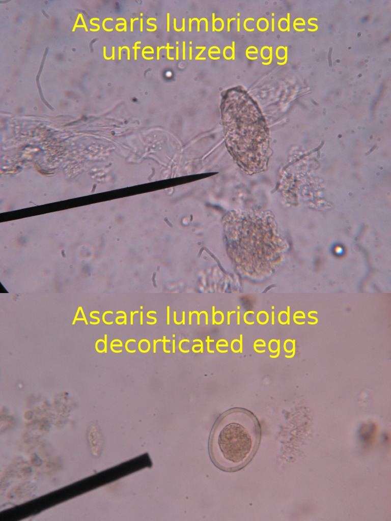 Parasitology Pictures Part 2 | PDF