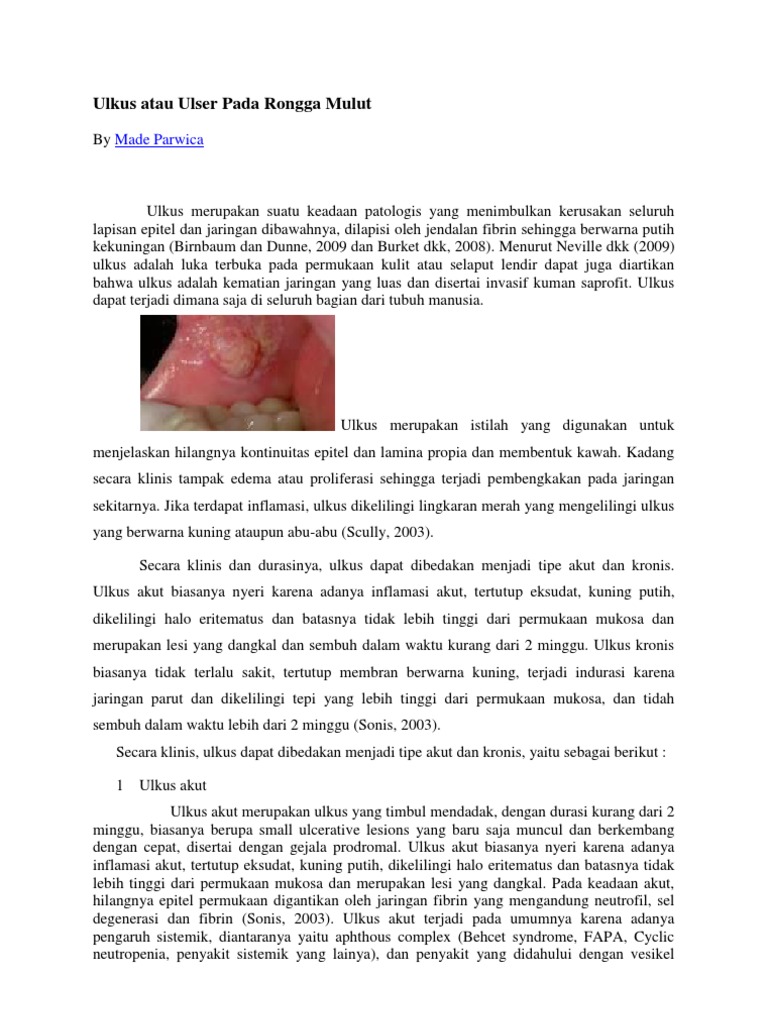 Ulkus Atau Ulser Pada Rongga Mulut | PDF