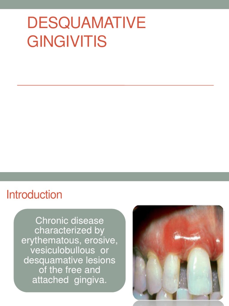 Desquamative Gingivitis | PDF | Cutaneous Conditions | Diseases And Disorders