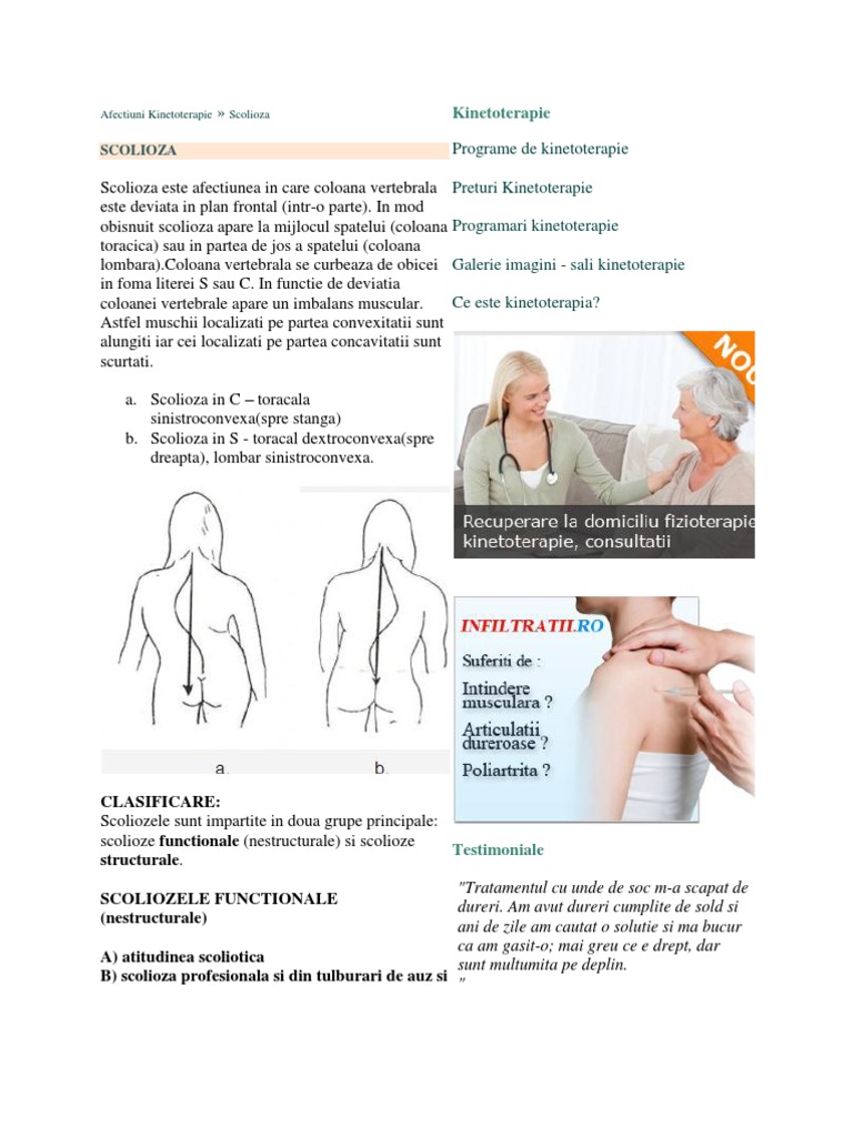 Scolioza Dextroconvexa | PDF