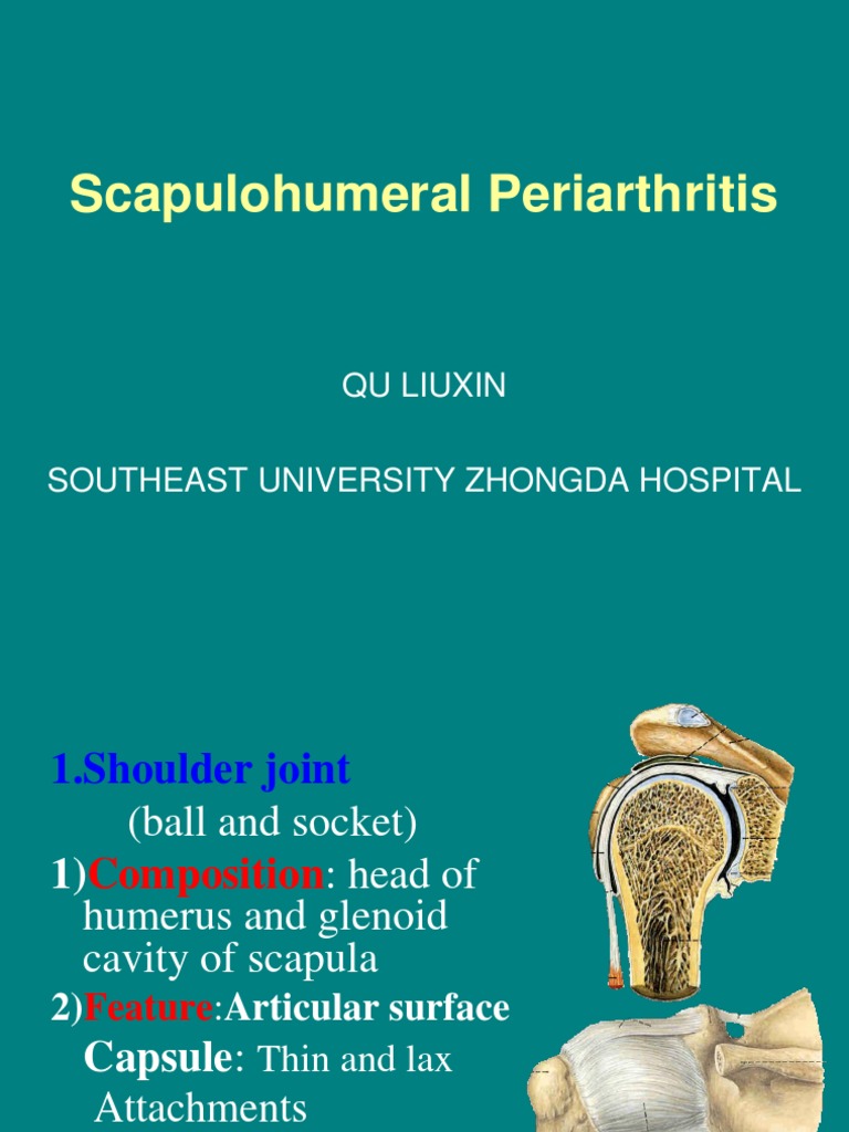Scapulohumeral Periarthritis | Shoulder | Musculoskeletal System