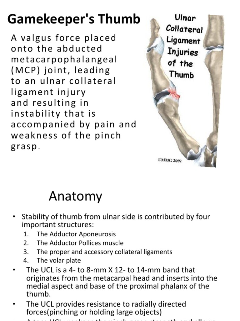 Gamekeeper's Thumb: Anatomy, Mechanism of Injury, Clinical Features ...