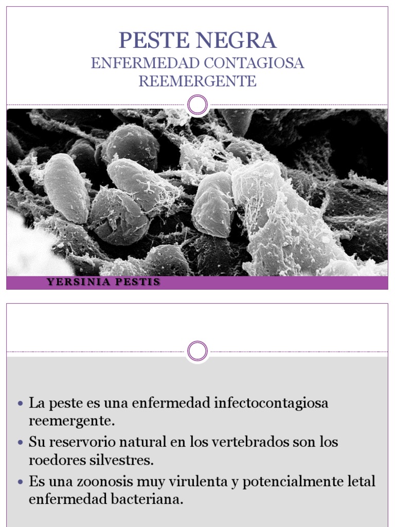 Peste Negra | Plaga (Enfermedad) | Peste negra