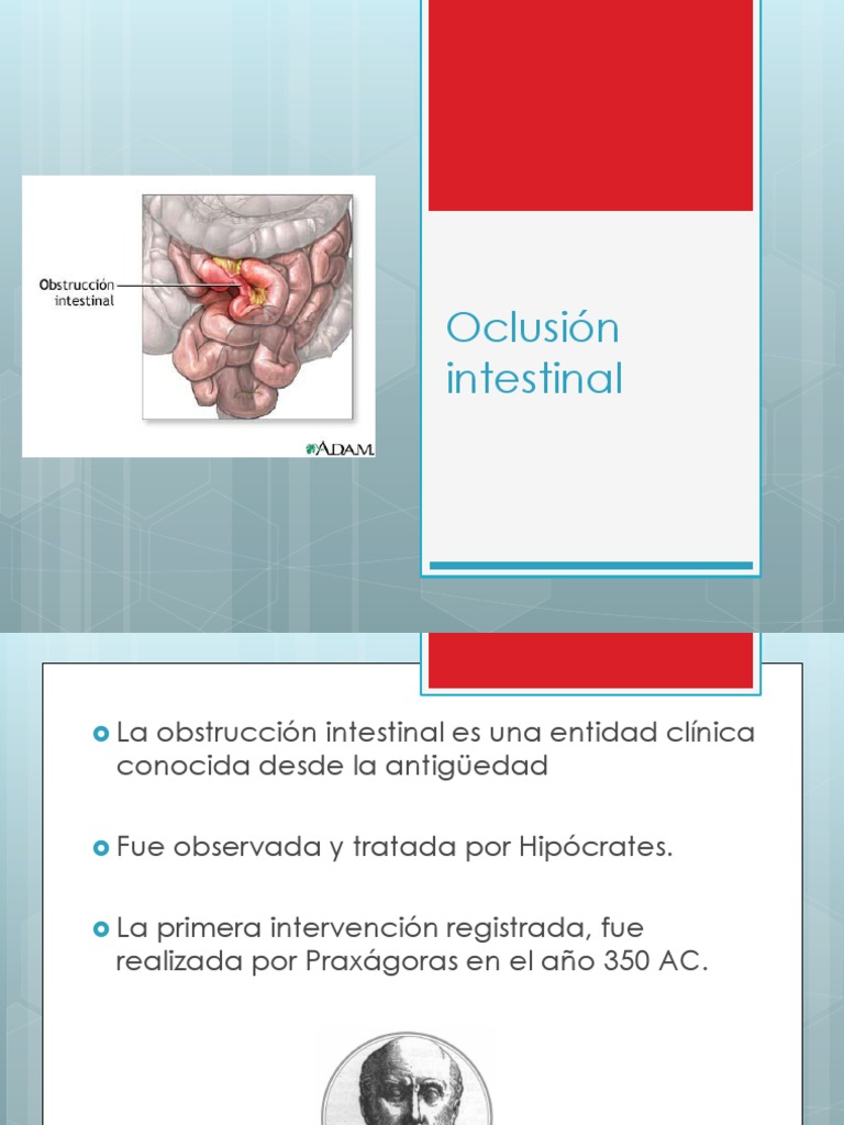 Oclusión intestinal | Especialidades Medicas | Medicina CLINICA