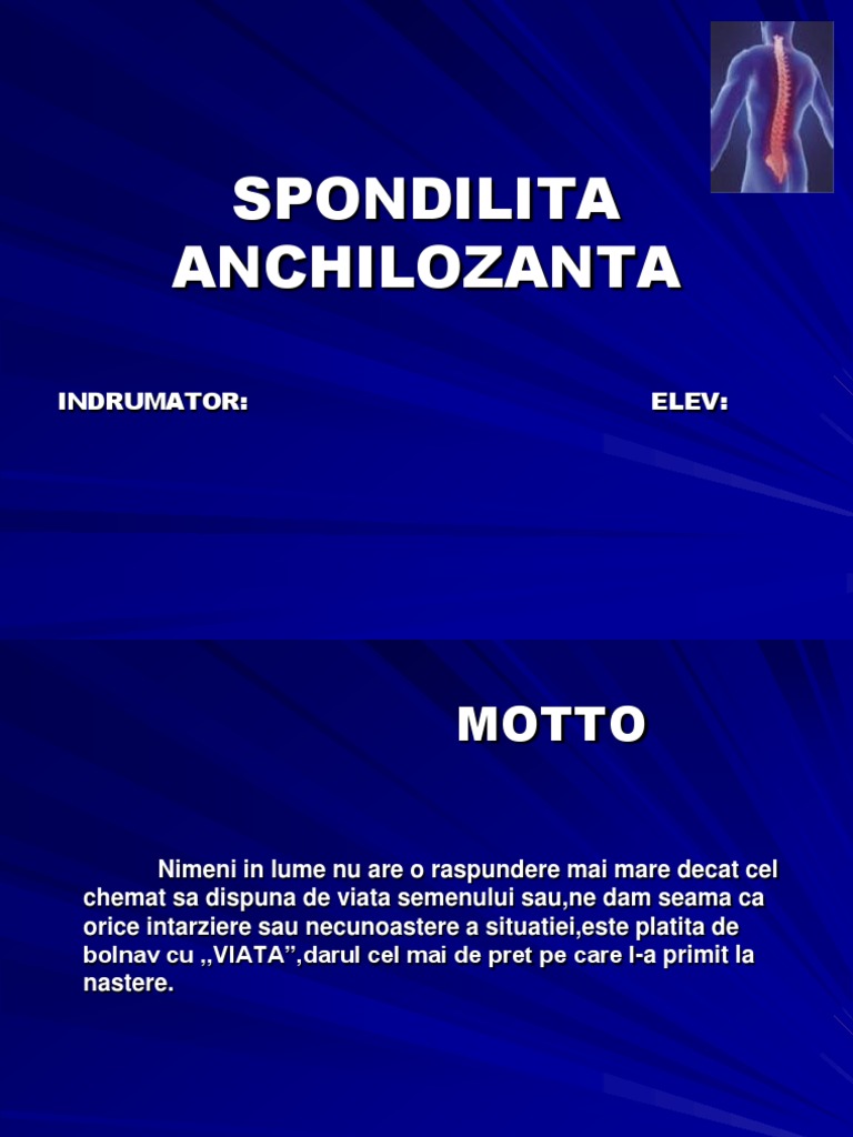 Spondilita | PDF